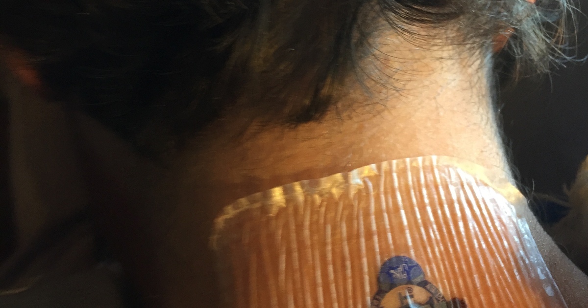 ANGIOMA ALLIANCE - Allison Mintz's fundraiser