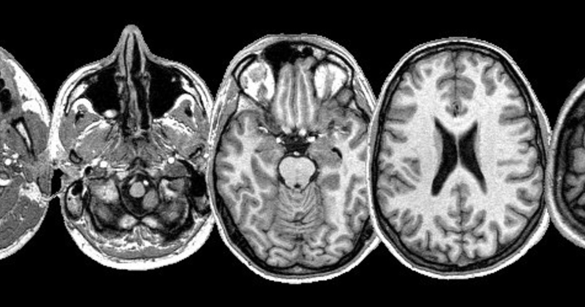 Regional Medical Center - MRI